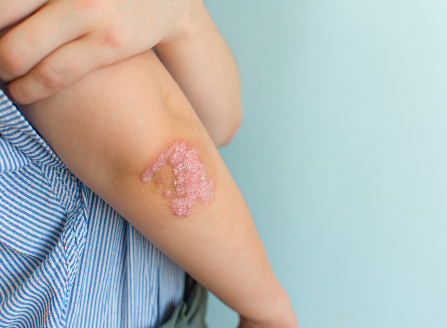 Skin Treatments – Armoraa